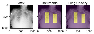 torchxrayvision · PyPI